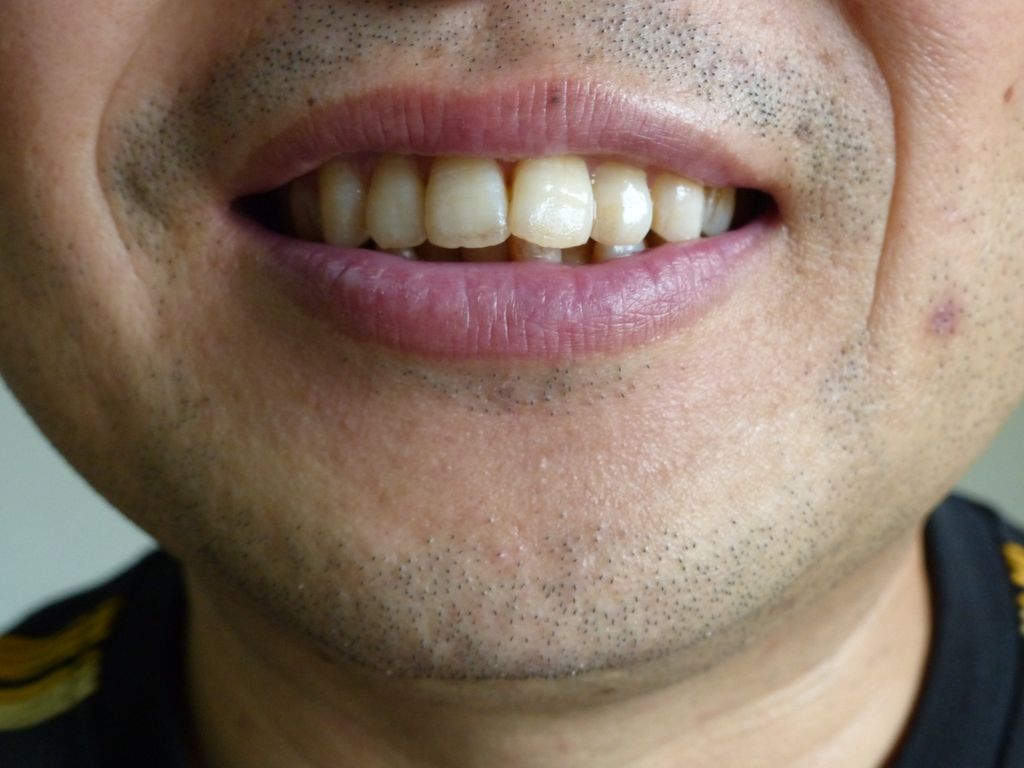 Dollar Street - photos as data to kill country stereotypes